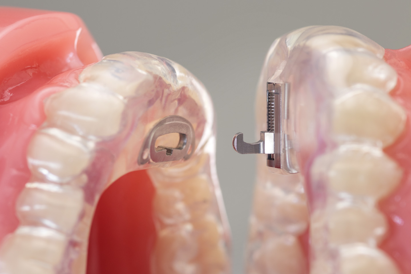 Schnarchschienen - Best Dental
