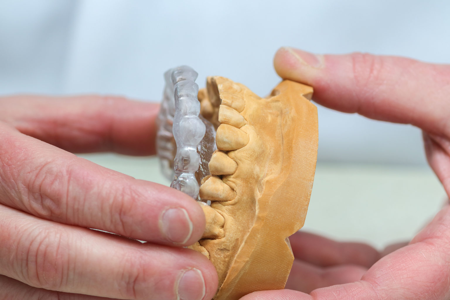 Aufbiss-Schienen - Best Dental